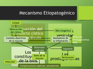 Colecistitis Aguda.pptx
