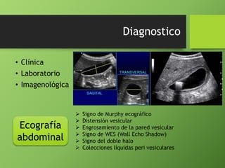 Colecistitis Aguda.pptx