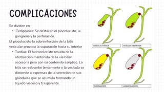Colecistitis aguda anatomia fisiologia defin | PPTX