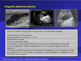 Colecistitis aguda | PDF