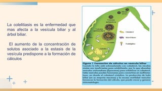 Colecistitis aguda y patología biliar.pptx
