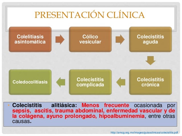 Colecistitis aguda y colelitiasis Colecistitis aguda y colelitiasis