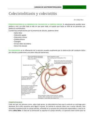 Colecistolitiasis y colecistitis | PDF