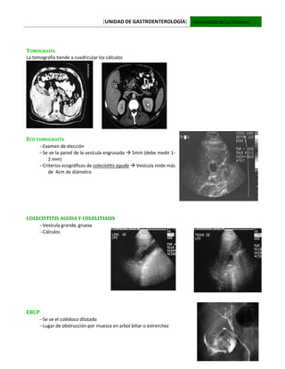 Colecistolitiasis y colecistitis | PDF