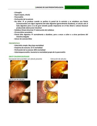 Colecistolitiasis y colecistitis | PDF