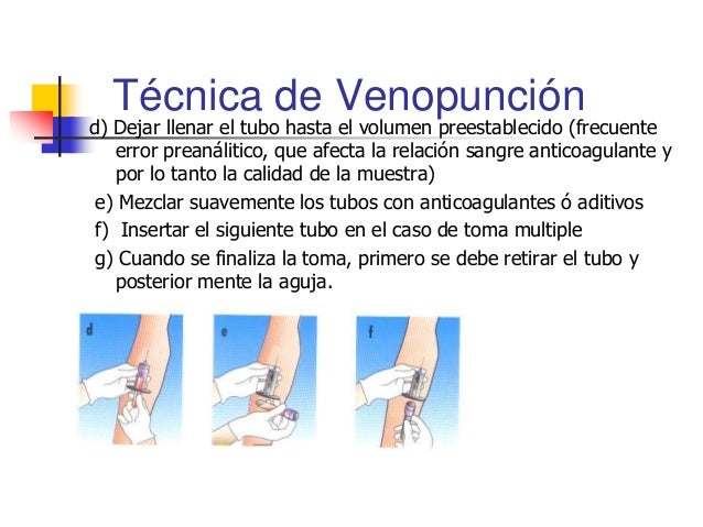 Colecta y venopuncion (2)