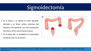 Técnicas quirúrgicas específicas en cirugía de Colon (Colectomías).pptx