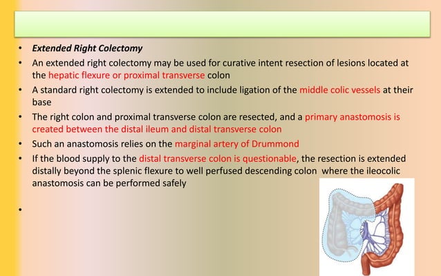 Colectomy | PPTX