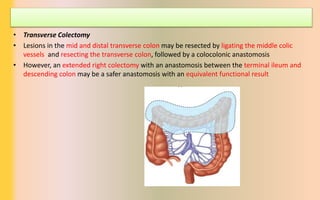 Colectomy | PPTX