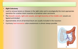 Colectomy | PPT