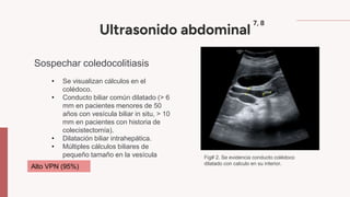 Coledocolitiasis.pptx