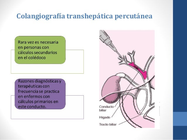 Coledocolitiasis colangitis fistulas biliares e ileo biliar