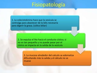 Colelitiasis | PPTX