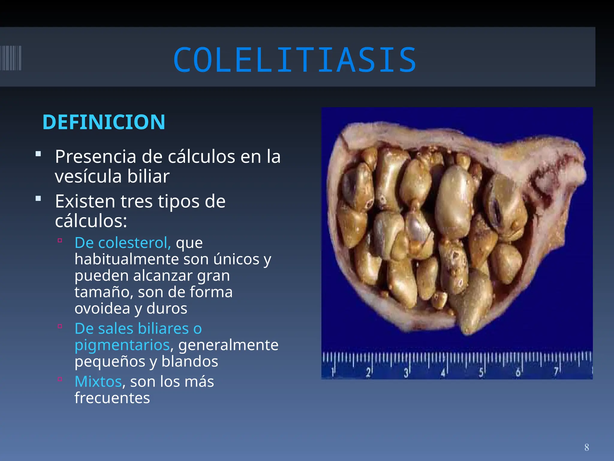 enfermedades de la vesícula biliar, gastroenteritis y colelitiasis.ppt