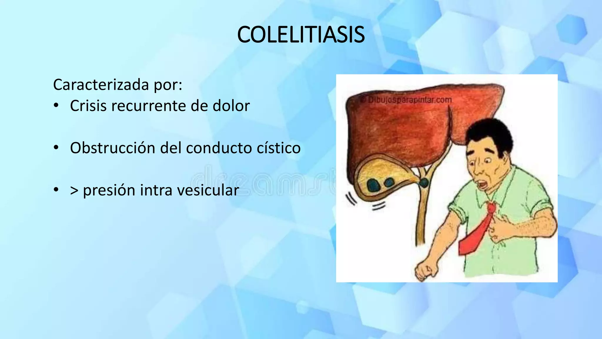 colelitiasis,colico biliar y colecistitis aguda letícia leit.pptx