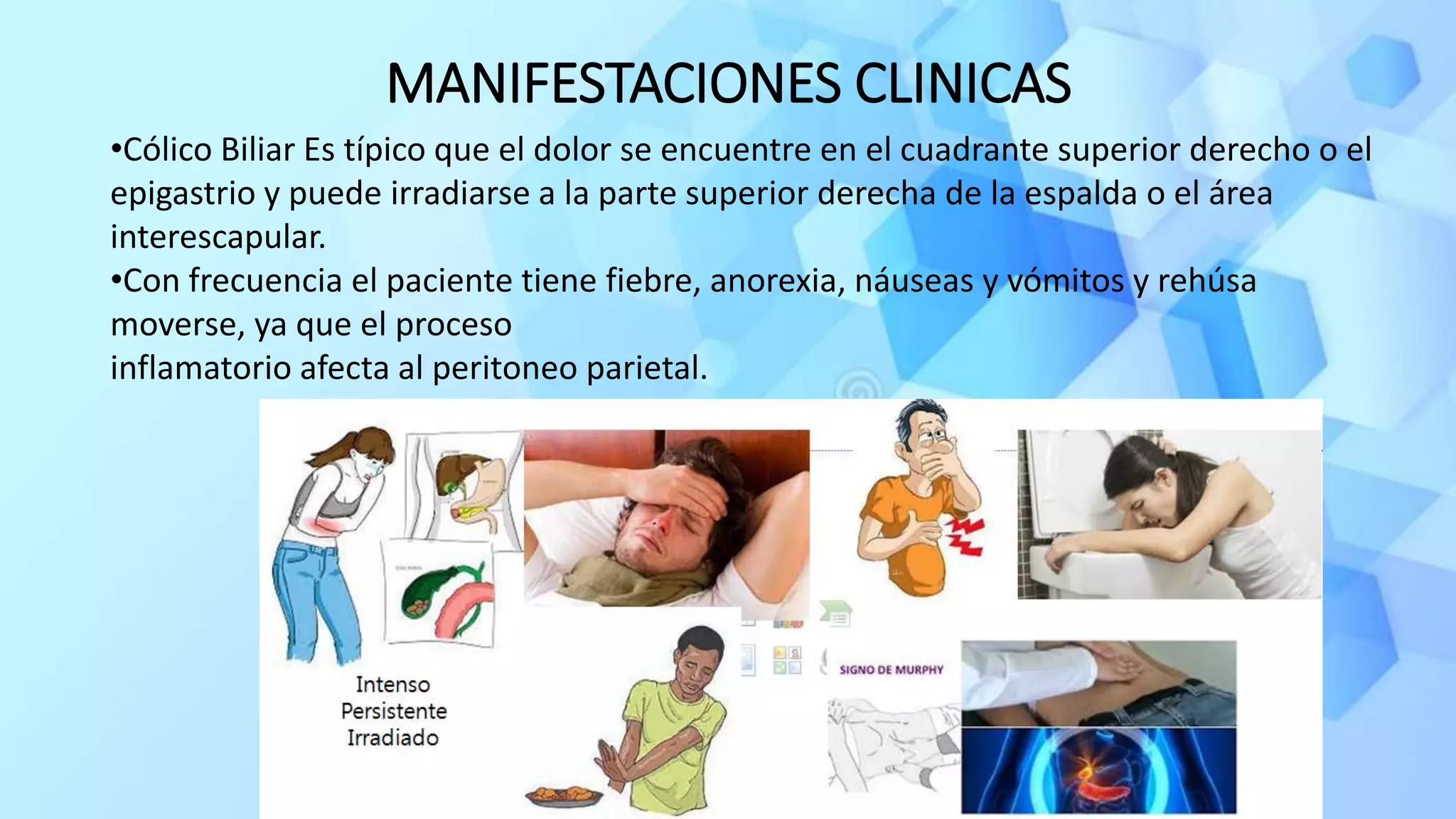 colelitiasis,colico biliar y colecistitis aguda letícia leit.pptx