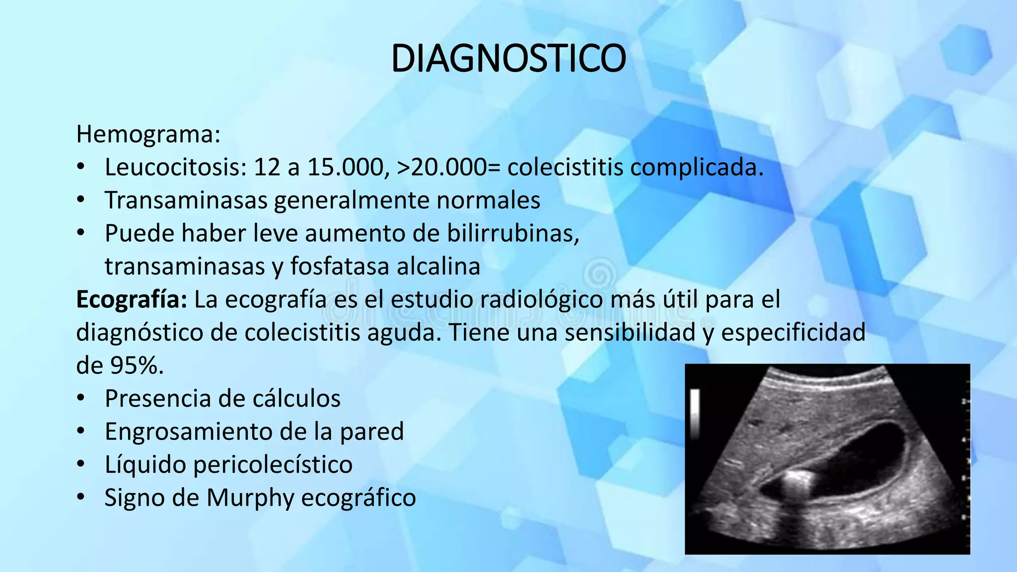 colelitiasis,colico biliar y colecistitis aguda letícia leit.pptx
