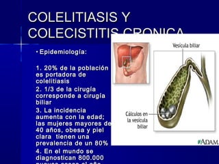 Colelitiasis dr bayohan | PPT