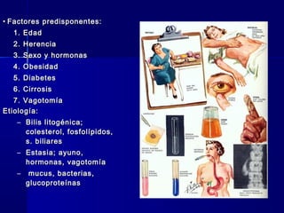 Colelitiasis dr bayohan | PPT