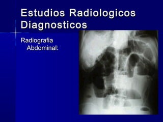 Colelitiasis dr bayohan | PPT