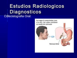 Colelitiasis dr bayohan | PPT