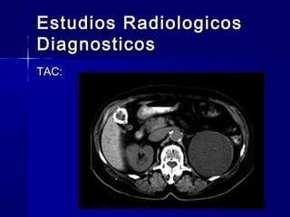 Colelitiasis dr bayohan | PPT