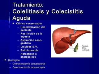 Colelitiasis dr bayohan | PPT