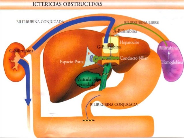 Colestasis generalidades