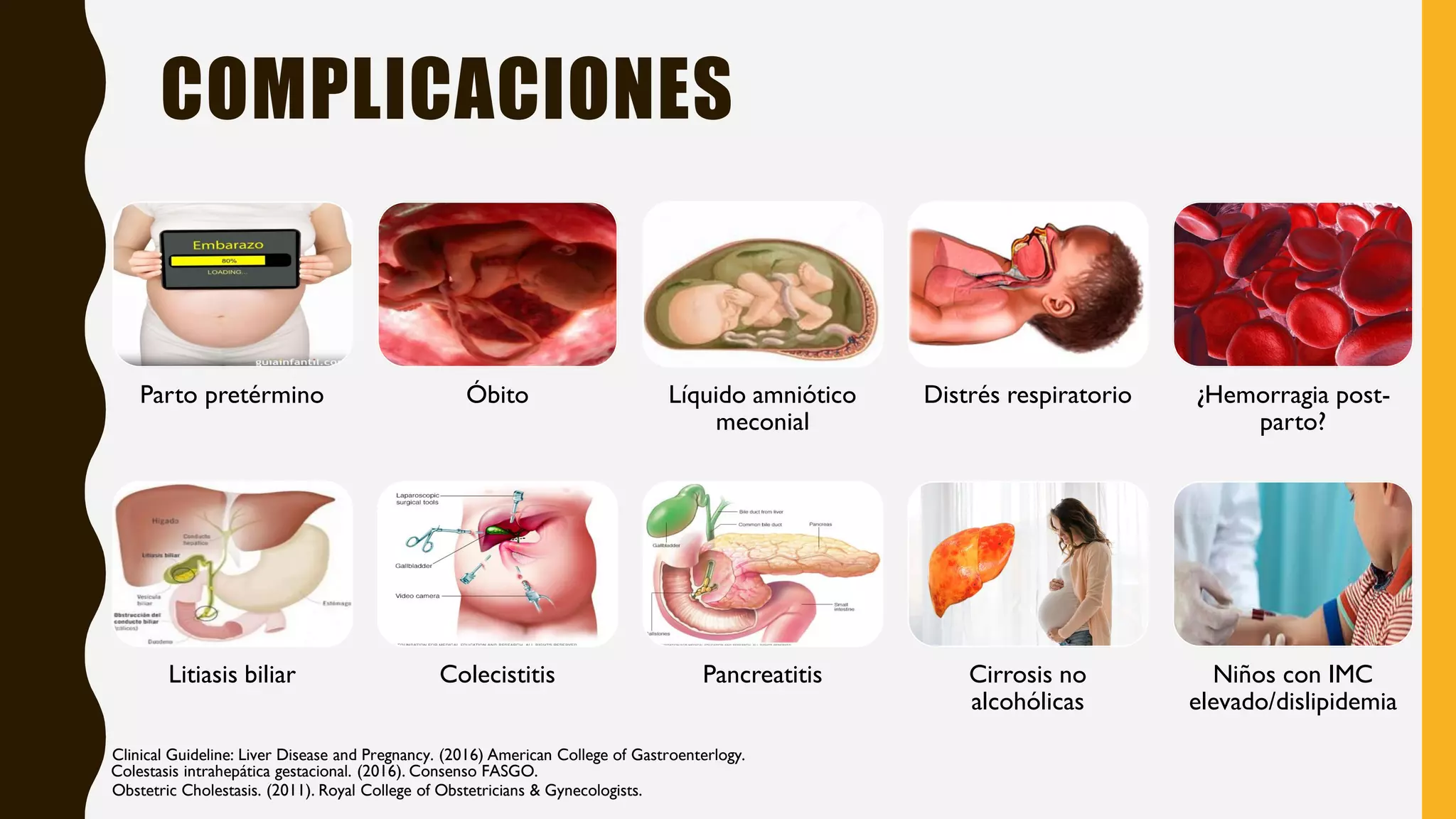 Colestasis intrahepática del embarazo | PDF | Pregnancy | Reproductive ...