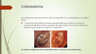 Colesteatoma | PPT