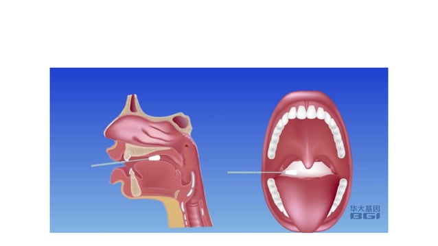 COLETA DE SECREÇÃO DE OROFARINGE,.pdf