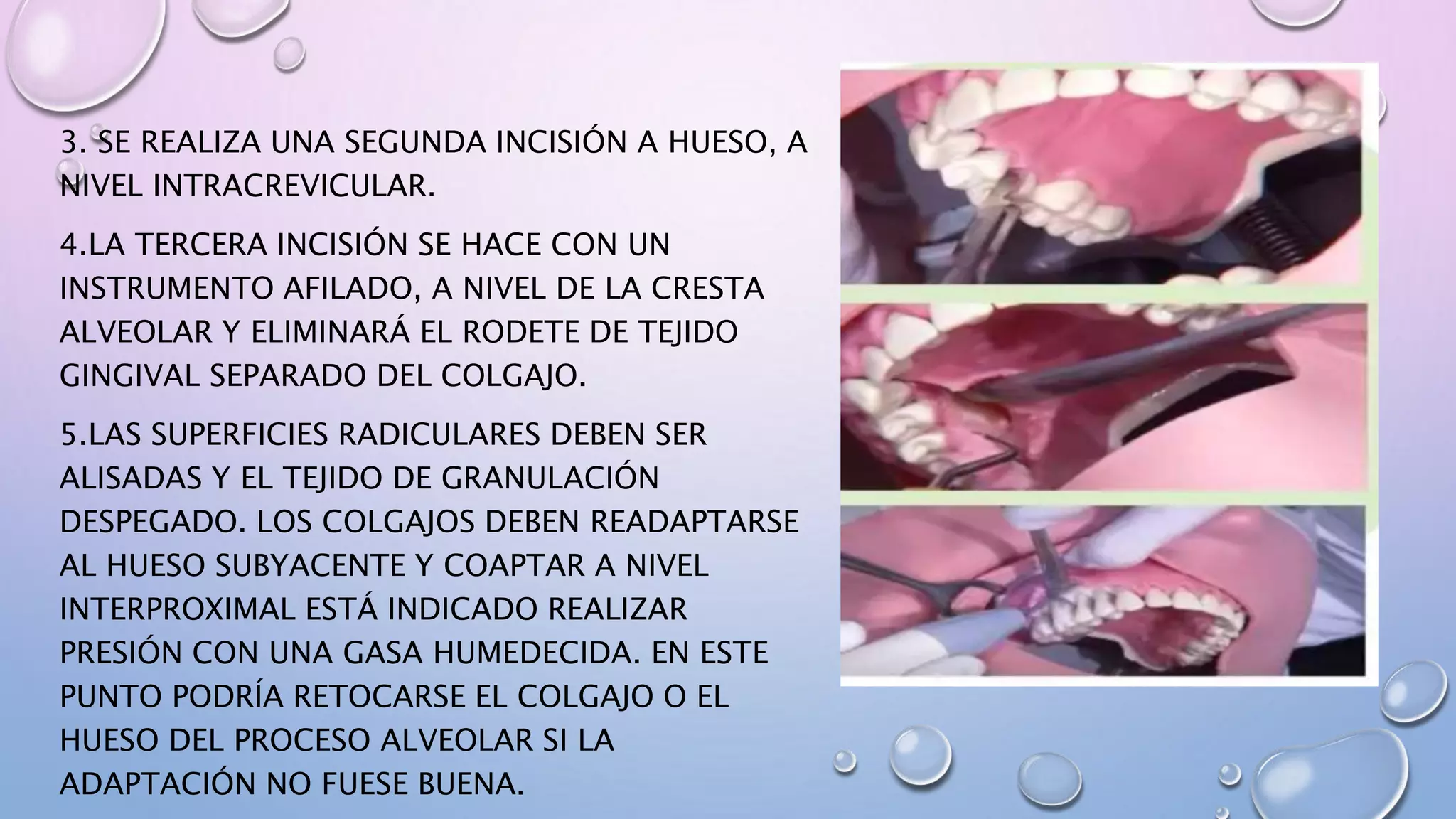 COLGAJO DE WIDMAN MODIFICADO.pptx