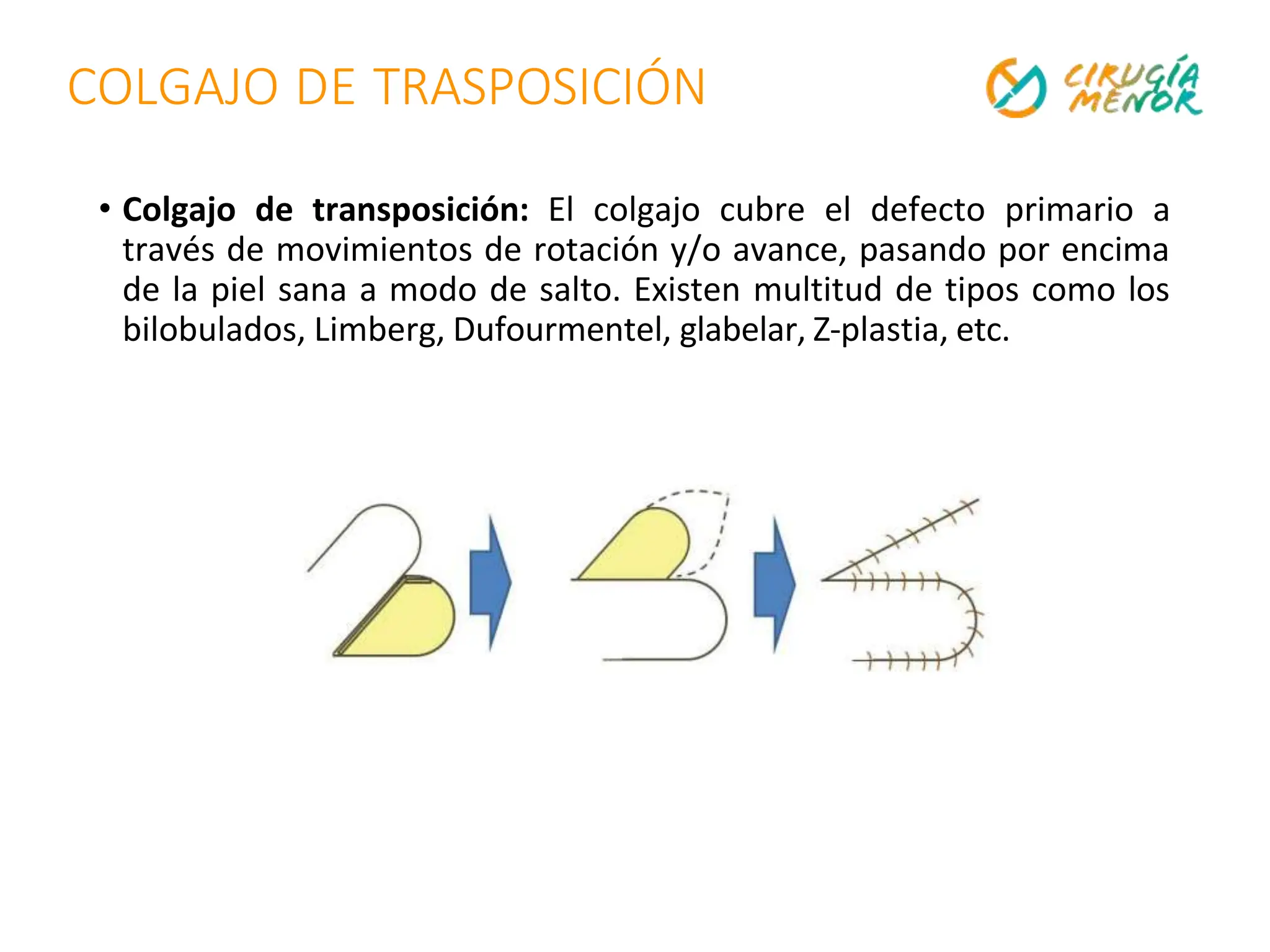 INJERTOS Y TIPOS DE COLGAJOS EN CIRUGIA MENOR | PPTX