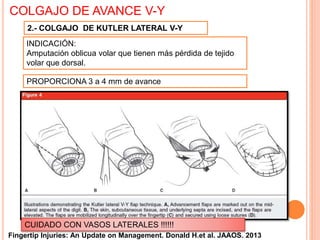 Colgajos cutaneos expo | PPTX