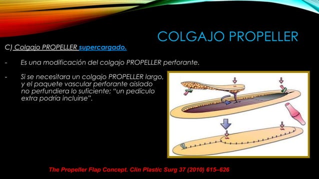 Colgajos fasciocut cmc | PPT