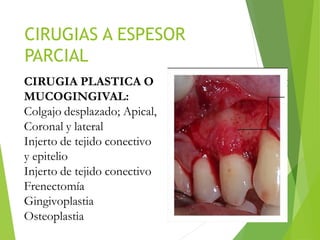 COLGAJOS PERIODONTALES TEMA 10.pdf