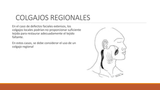 COLGAJOS REGIONALES EN CIRUGÍA MAXILOFACIAL.pdf