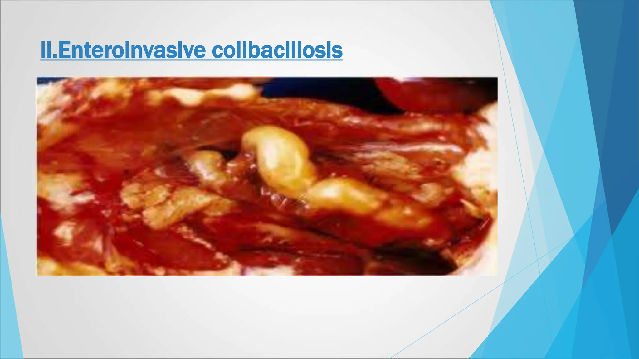 colibacillosis.pptcolibacillosis.ppt colibacillosis.pptcolibacillosis.ppt