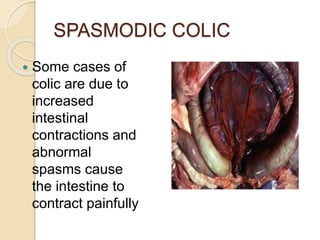 Colic by bharti raj sondhi(types and nutritional therapy and ...