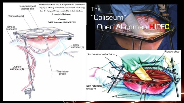 A Coliseum with frail foundations: a critical analysis of the state-o…