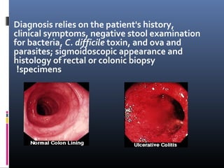 Colitis | PPT