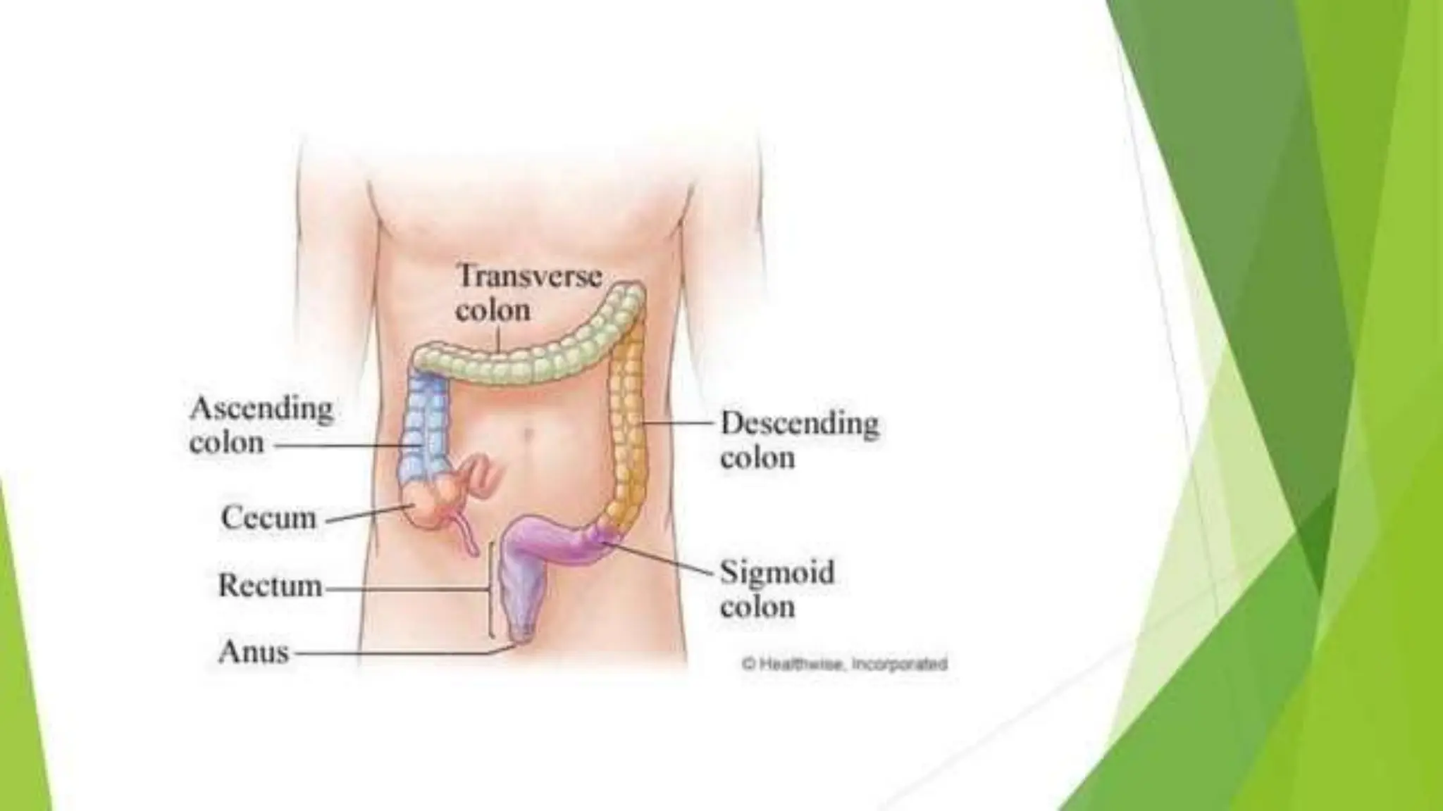 A clear understanding ppt on colitis.ppt