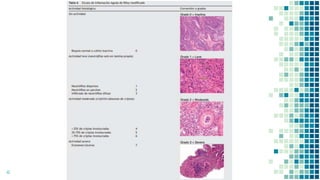 Colitis ulcerativa | PPTX