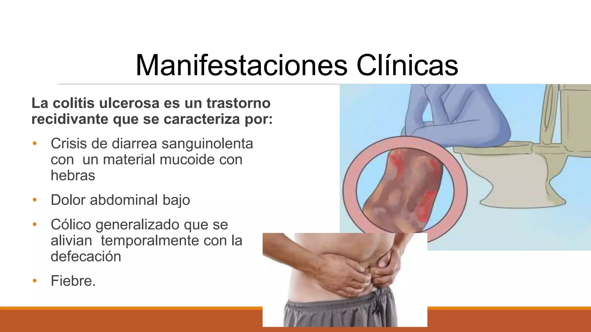 Colitis ulcerativa Caso Clínico | PPT