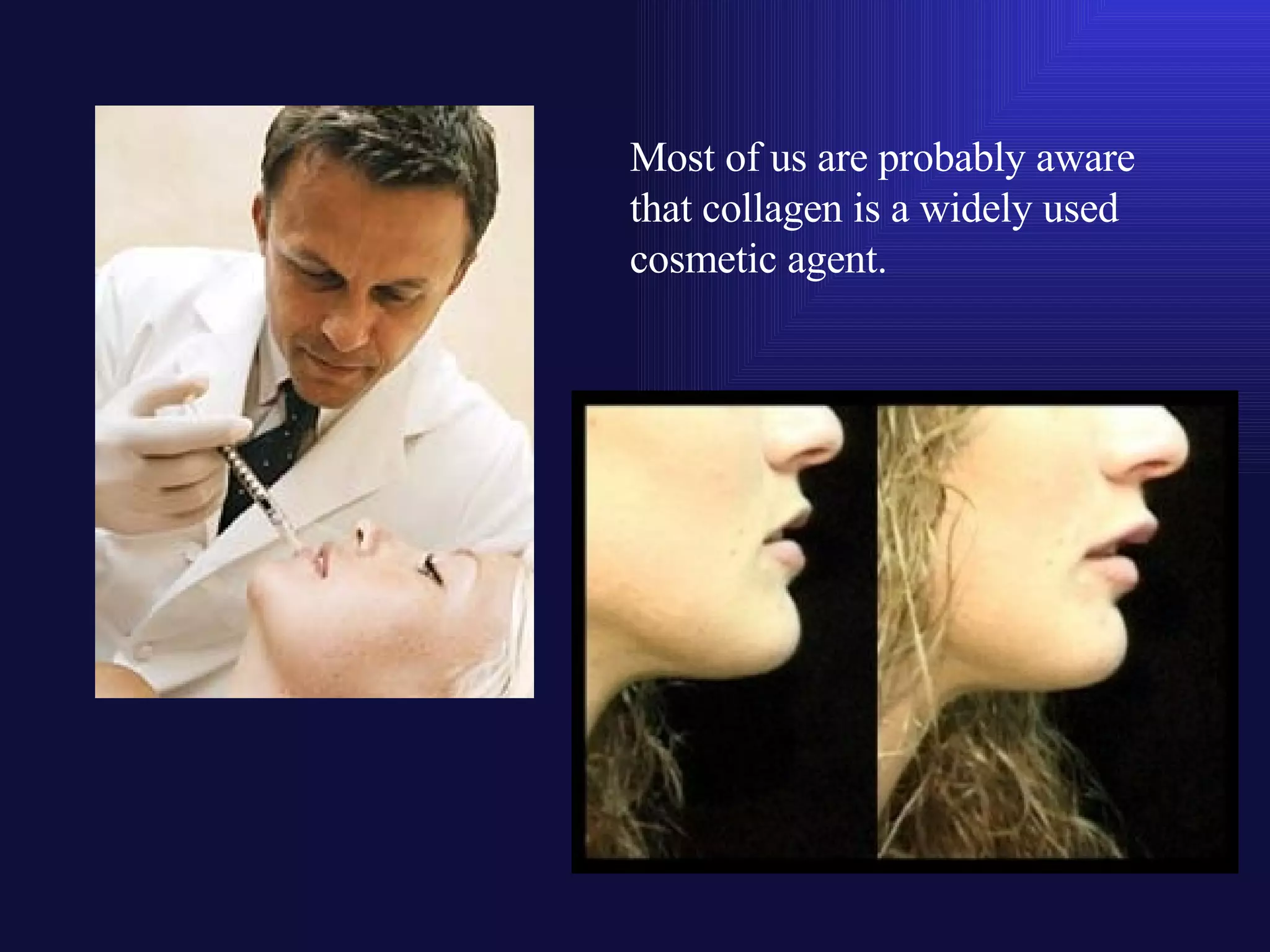 Collagen Biochemistry | PPT