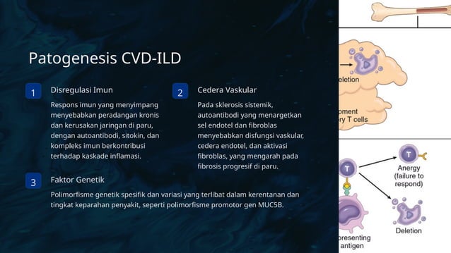 Collagen-Vascular-Disease-associated-Interstitial-Lung-Disease-CVD-ILD.pptx