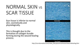 Collagen and cancellation of skin contraction | PPT
