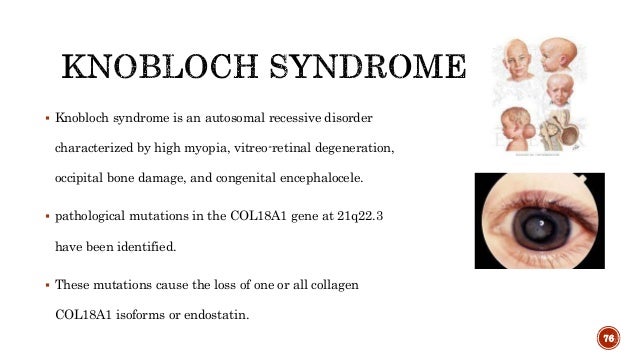 Collagen and collagen disorders