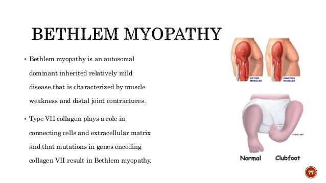 Collagen and collagen disorders