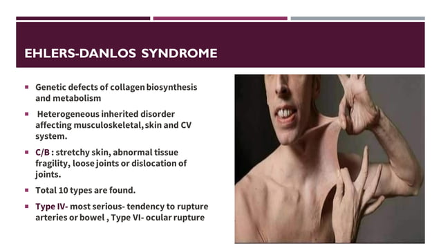 collagen and its disorders _.pdf